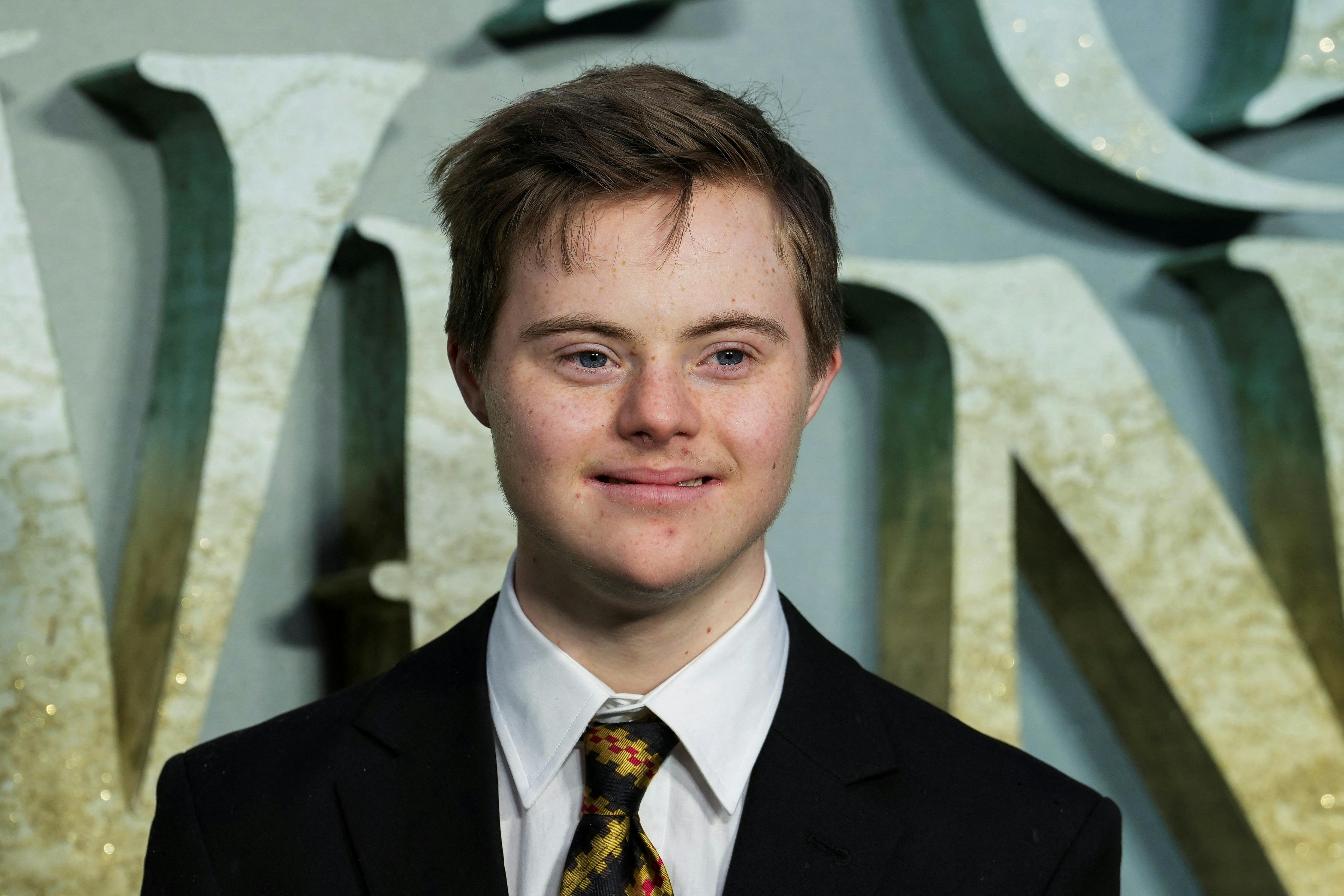 Han er den første skuespiller med Downs syndrom, som får en stor rolle ...