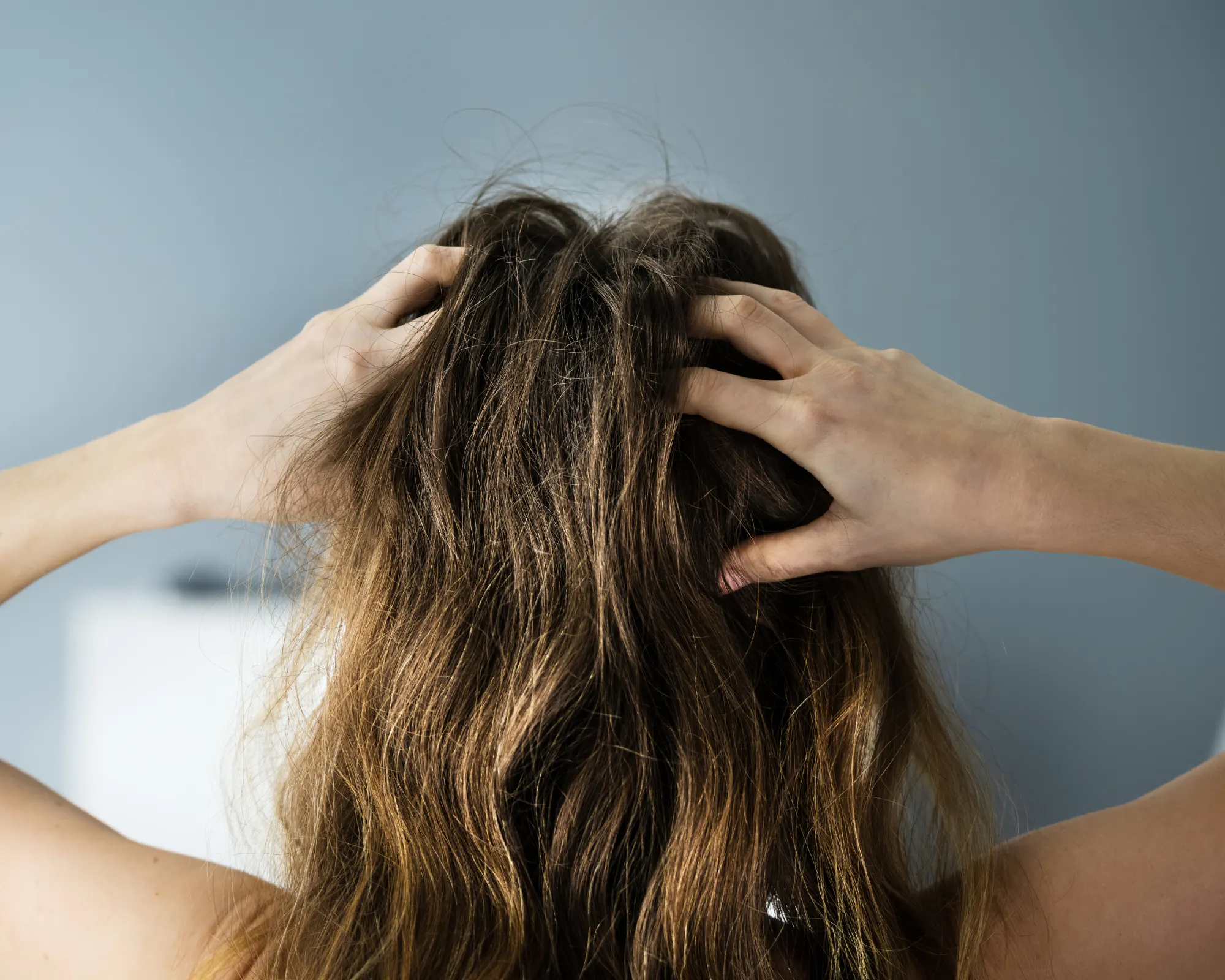 7 gode råd til at slippe af med tør hårbund | Femina